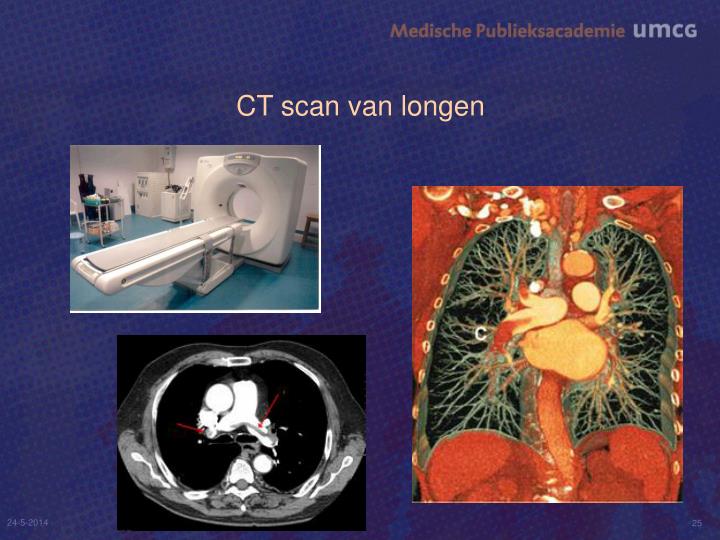 PPT - Trombose PowerPoint Presentation - ID:820263