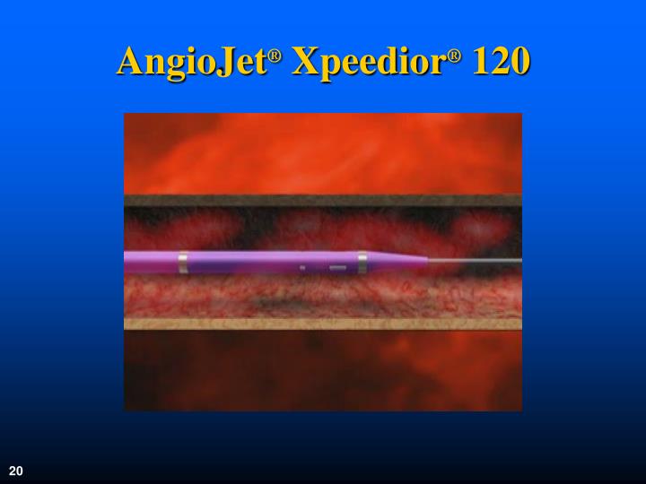 PPT - Deep Vein Thrombosis PowerPoint Presentation - ID:822146
