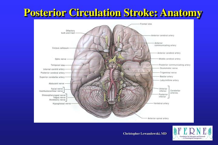 PPT - Posterior Circulation Stroke PowerPoint Presentation - ID:822160
