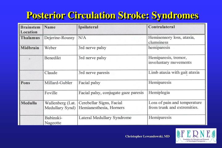PPT - Posterior Circulation Stroke PowerPoint Presentation - ID:822160