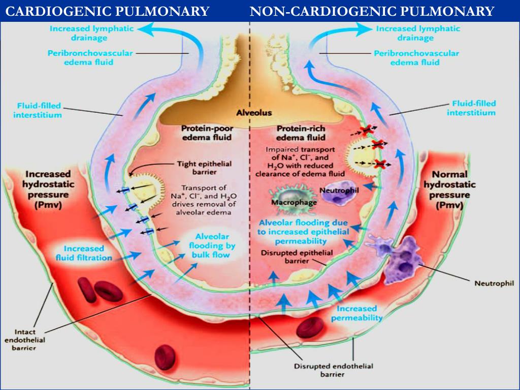 PPT Heart Failure PowerPoint Presentation Free Download ID 824406 PPT Heart Failure PowerPoint Presentation Free Download ID 824406