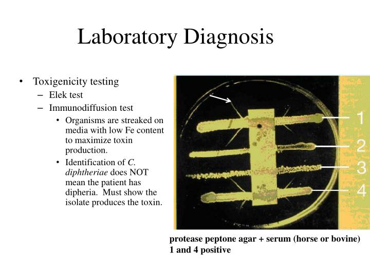 PPT - Coryneform bacteria, listeria and erysipelothrix PowerPoint ...