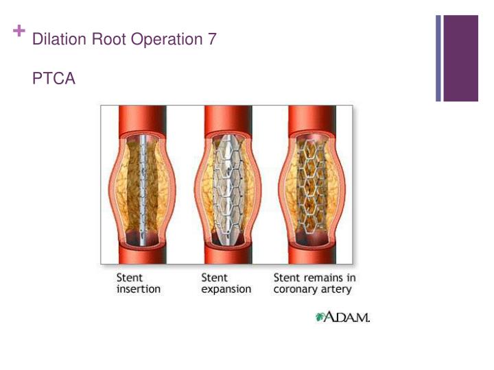 PPT - Introduction to ICD-10 PCS PowerPoint Presentation - ID:826011