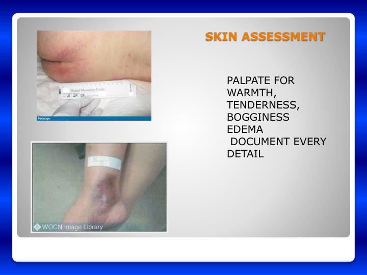 PPT - Head to Toe Skin Assessment PowerPoint Presentation - ID:826488