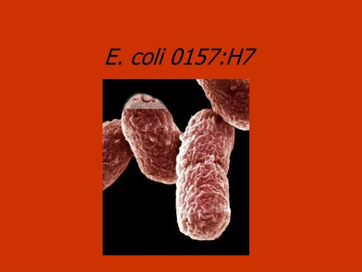 PPT - E. coli 0157:H7 PowerPoint Presentation, free download - ID:829431
