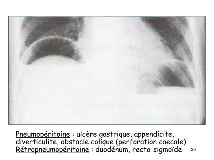 PPT - Douleur abdominale et urgence PowerPoint Presentation - ID:829866