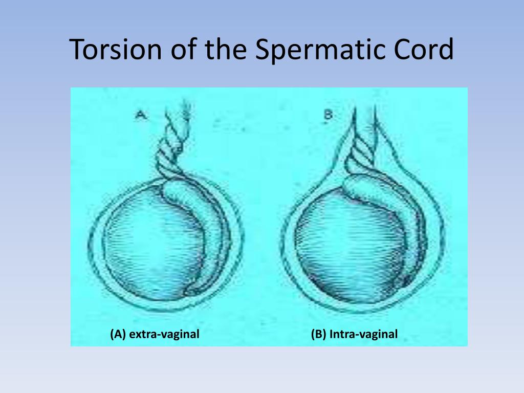 Ppt Emergency In Urology Powerpoint Presentation Free Download Id