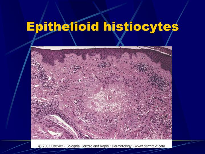 PPT - Monocyte/Macrophage Disorders PowerPoint Presentation - ID:832761