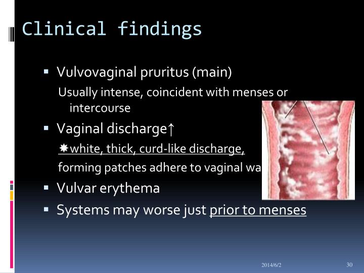 PPT - Female Genital System infection PowerPoint Presentation - ID:833723