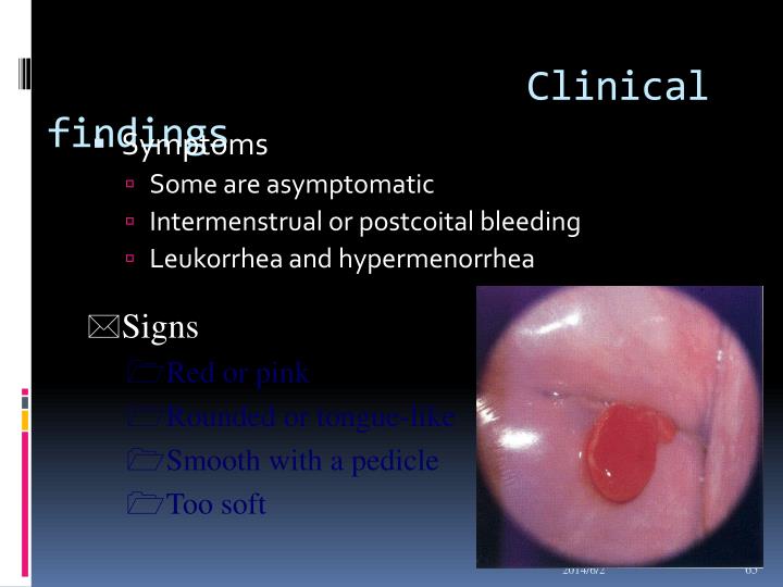 PPT - Female Genital System infection PowerPoint Presentation - ID:833723