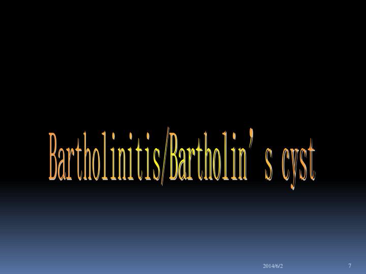 PPT - Female Genital System infection PowerPoint Presentation - ID:833723