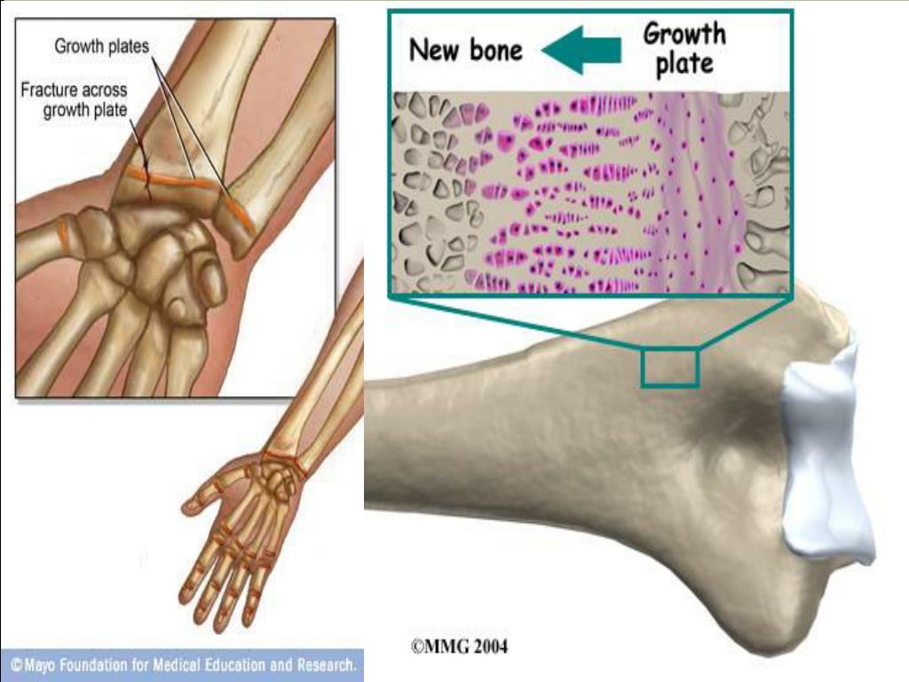 PPT - Sports Medicine I PowerPoint Presentation, free download - ID:834049