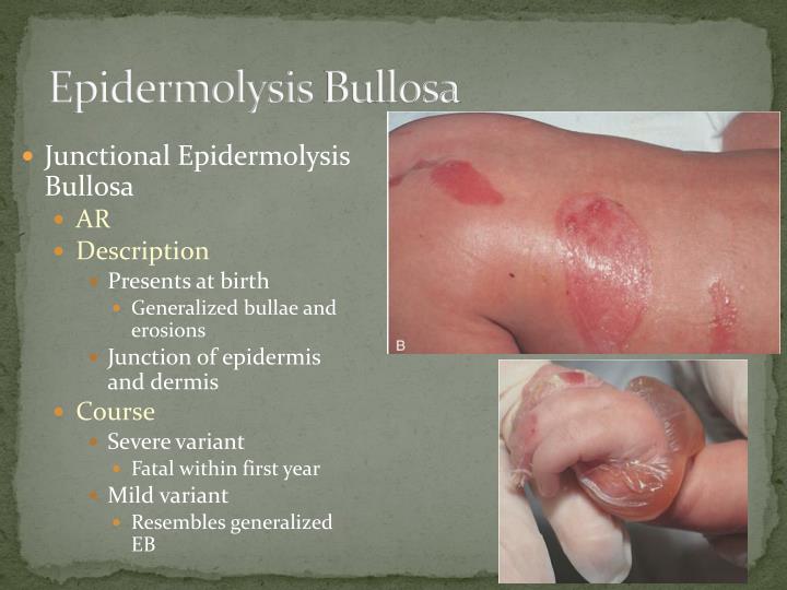 PPT - Other Infantile Rashes PowerPoint Presentation - ID:834259