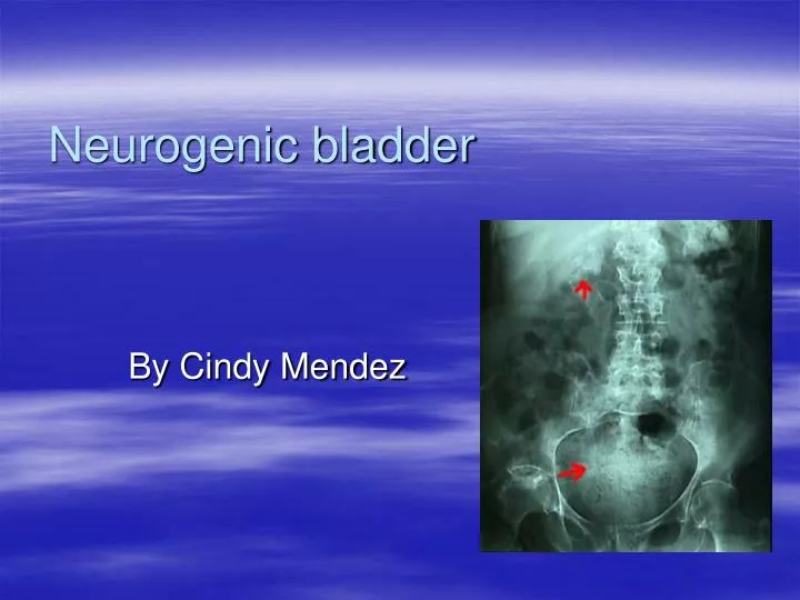 PPT - Neurogenic bladder PowerPoint Presentation, free download - ID:834467
