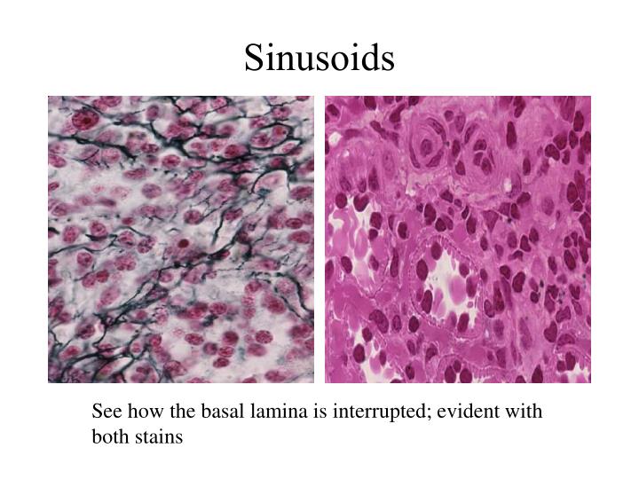 PPT - Thymus and Spleen PowerPoint Presentation - ID:836608