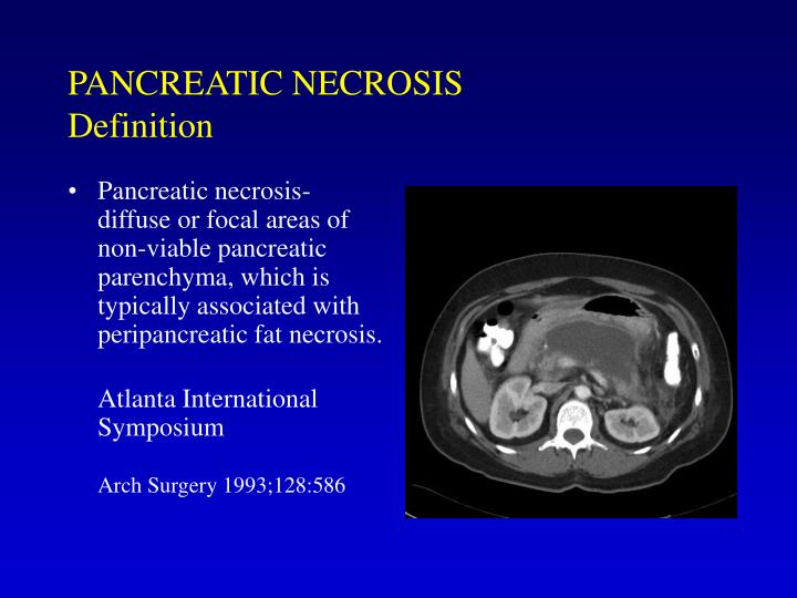 PPT - MANAGEMENT OF PANCREATIC NECROSIS PowerPoint Presentation - ID:83671