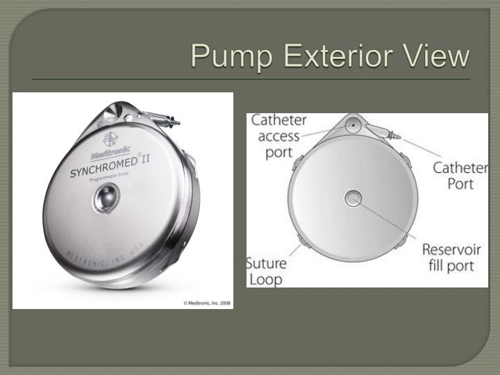 PPT - Intrathecal Baclofen Pump PowerPoint Presentation - ID:837111