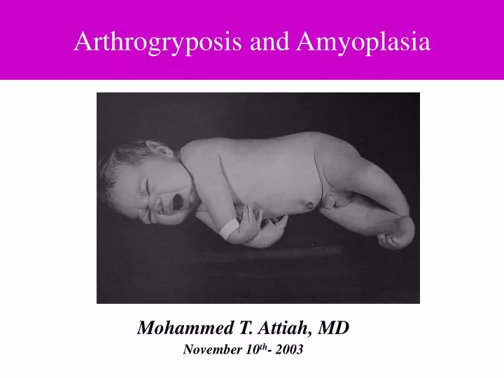 PPT - Arthrogryposis and Amyoplasia PowerPoint Presentation, free ...