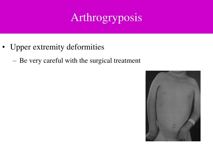 PPT - Arthrogryposis and Amyoplasia PowerPoint Presentation - ID:839019