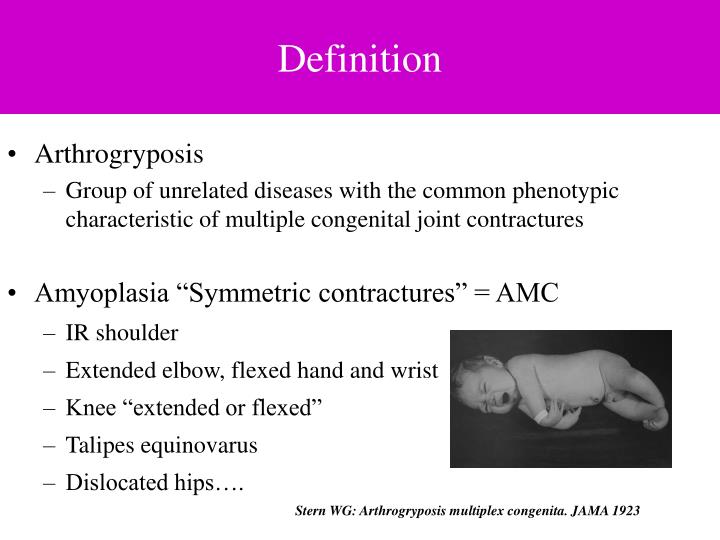 PPT - Arthrogryposis and Amyoplasia PowerPoint Presentation - ID:839019