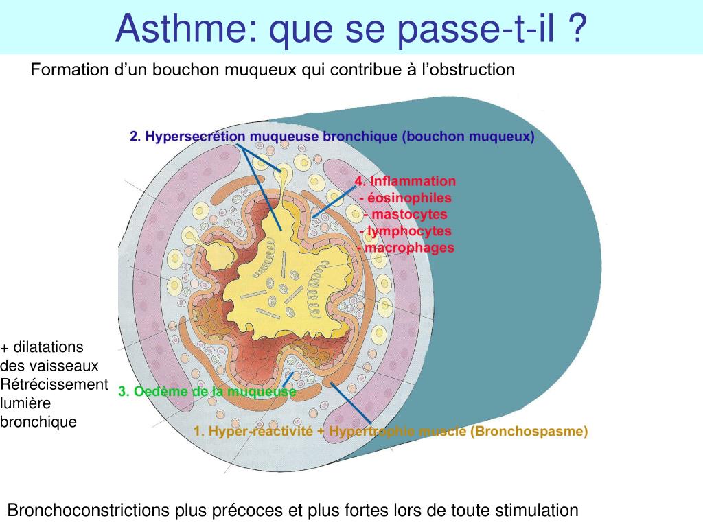 PPT - Traduction anatomo-pathologique des maladies chroniques ...