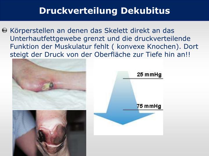PPT - Dekubitus? PowerPoint Presentation - ID:841736