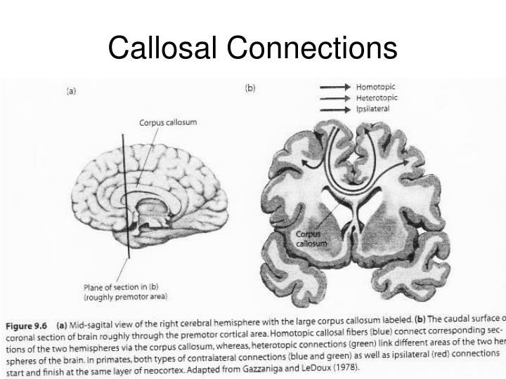 PPT - Dominant Hemisphere Identification PowerPoint Presentation - ID ...