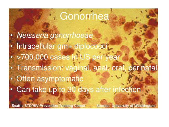 PPT - STD Overview PowerPoint Presentation - ID:846253