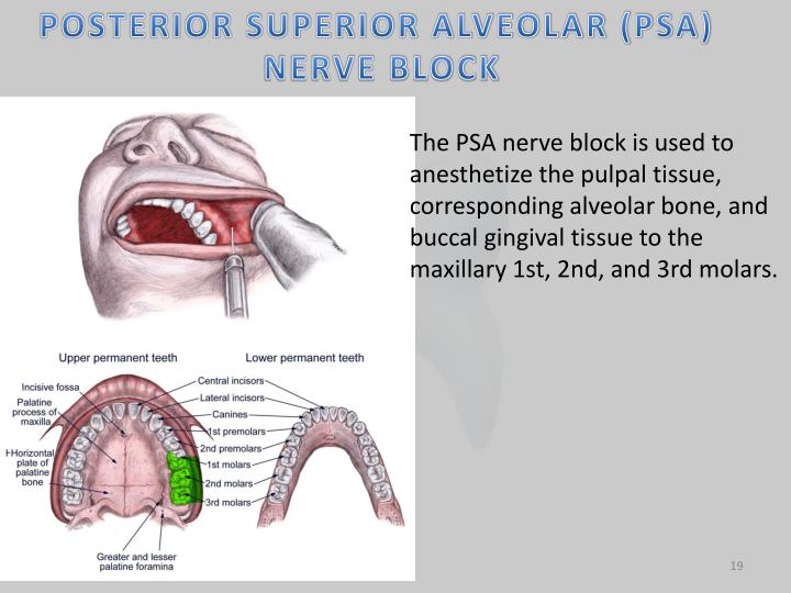 PPT - TRIGEMINAL NERVE PowerPoint Presentation - ID:846302