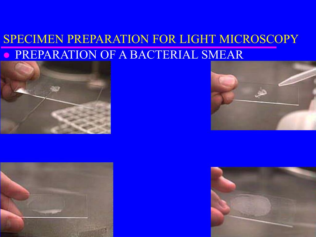 PPT - PREPARATION OF A BACTERIAL SMEAR SPECIAL STAINING TECHNIQUES ... PPT - PREPARATION OF A BACTERIAL SMEAR SPECIAL STAINING TECHNIQUES ...