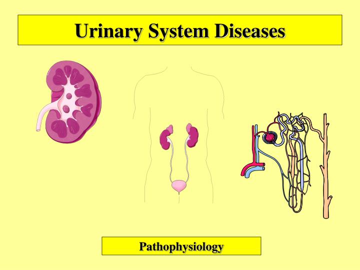 PPT - Urinary System Diseases PowerPoint Presentation, free download ...