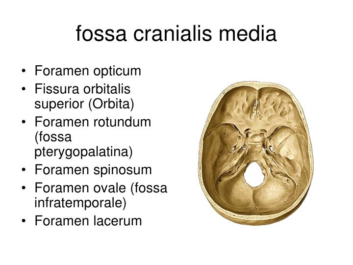 PPT - CRANIUM PowerPoint Presentation - ID:850502