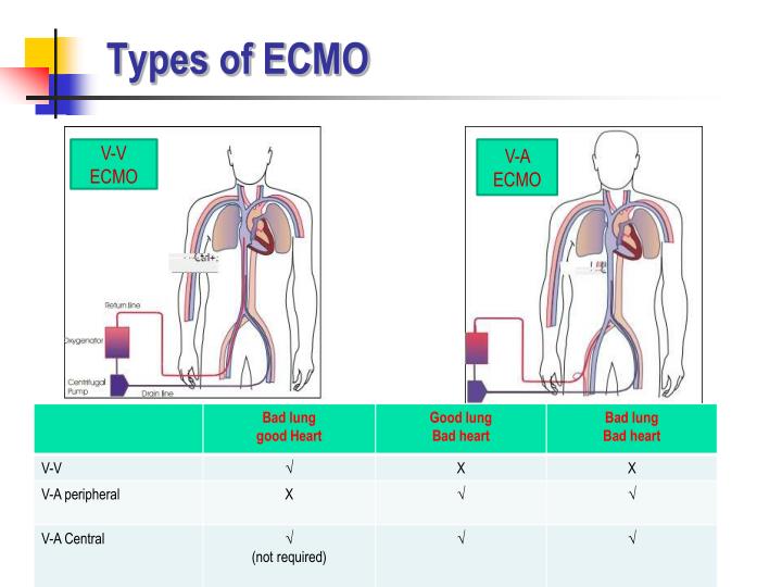 PPT - Autumn Respiratory Seminar 2010 Use of Extracorporeal Membrane ...