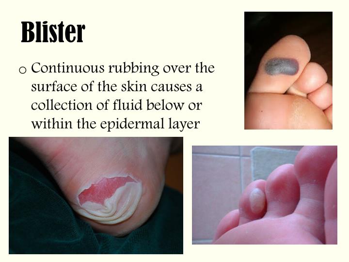 PPT - Skin Wounds Classification PowerPoint Presentation - ID:853573