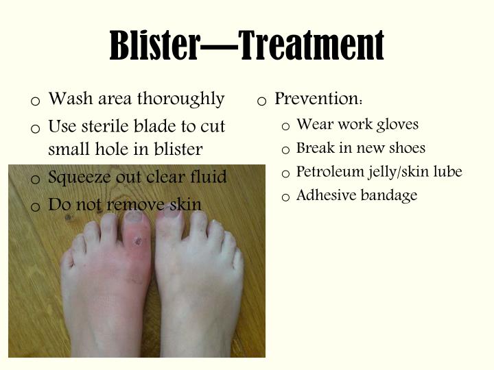 PPT - Skin Wounds Classification PowerPoint Presentation - ID:853573