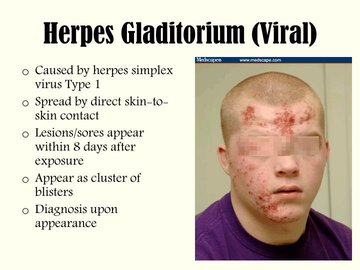 PPT - Skin Wounds Classification PowerPoint Presentation - ID:853573