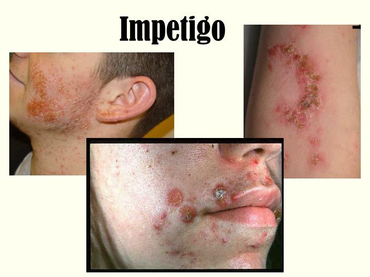 PPT - Skin Wounds Classification PowerPoint Presentation - ID:853573