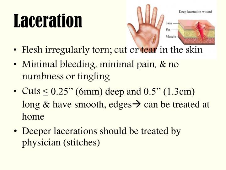 PPT - Skin Wounds Classification PowerPoint Presentation - ID:853573