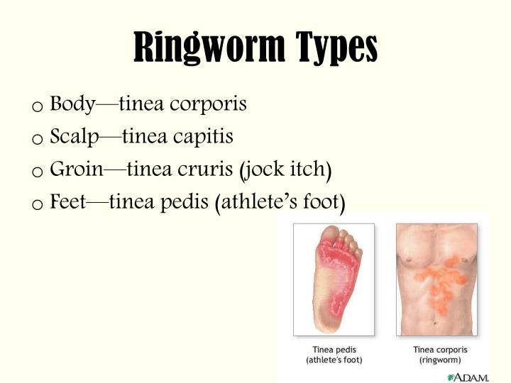 PPT - Skin Wounds Classification PowerPoint Presentation - ID:853573