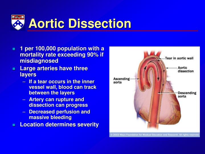 PPT - Approach to Chest Pain in the ED PowerPoint Presentation - ID:859542