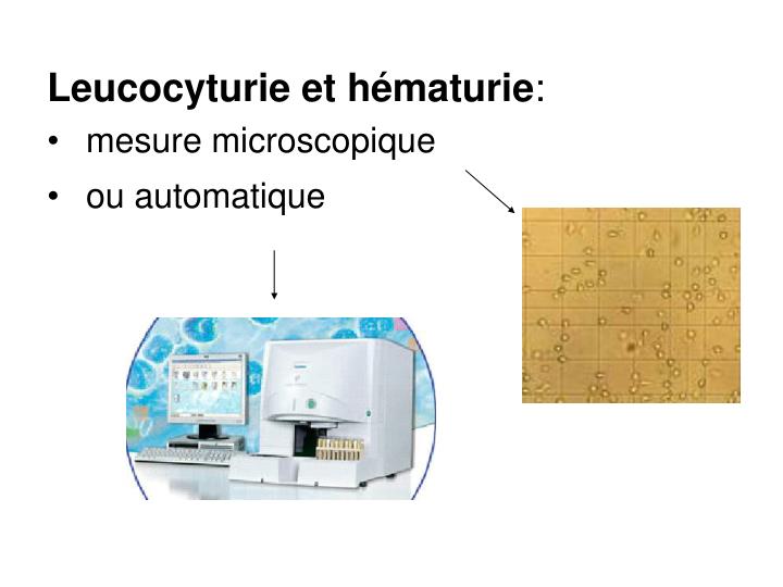 PPT - Examen cytobactériologique urinaire (ECBU) PowerPoint ...