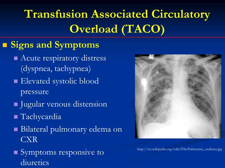PPT - New Approaches to Preventing Transfusion Reactions PowerPoint ...