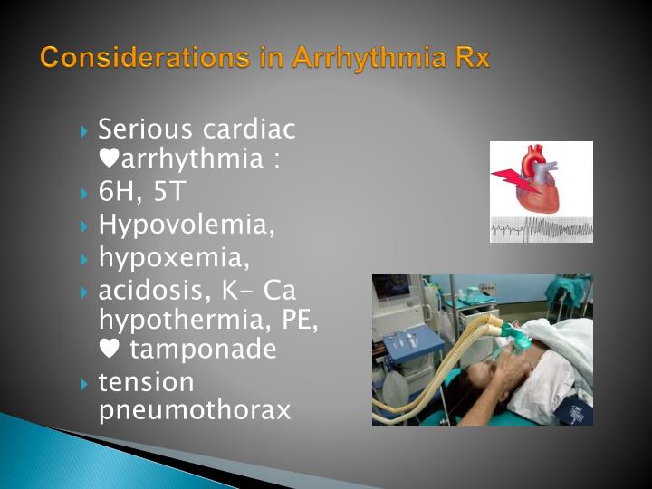 PPT - Cardiovascular Complications related to Anesthesia PowerPoint ...