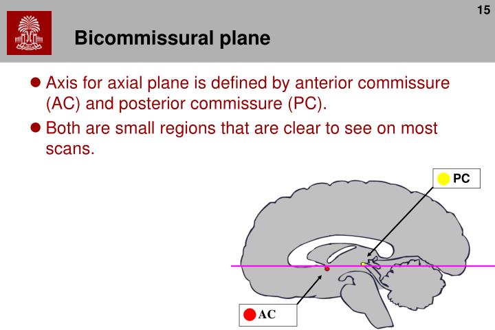 PPT - Basic Anatomy PowerPoint Presentation - ID:862793