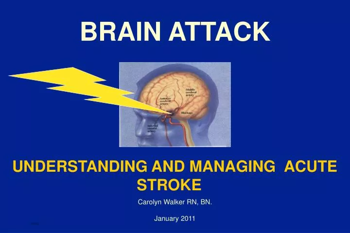 PPT - BRAIN ATTACK PowerPoint Presentation, free download - ID:863683
