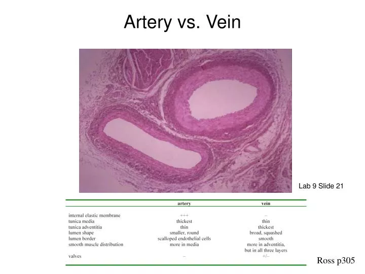 PPT - Artery vs. Vein PowerPoint Presentation, free download - ID:863691