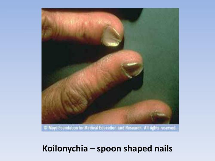 PPT - Haematology- Investigation of Anaemia PowerPoint Presentation ...