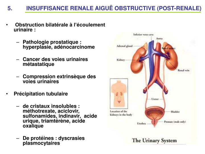 PPT - INSUFFISANCE RENALE AIGUË PowerPoint Presentation - ID:865018