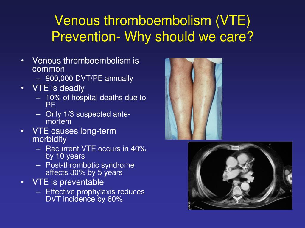 Ppt Hospital Acquired Venous Thromboembolism Powerpoint Presentation 28f