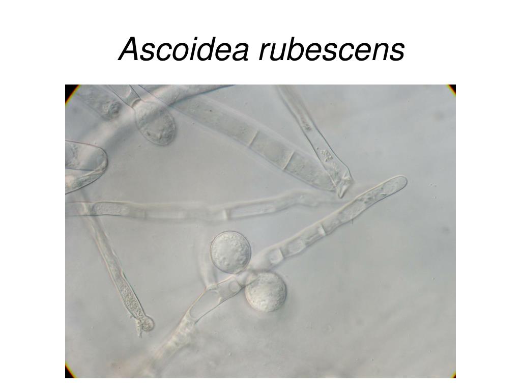 PPT - Archiascomycetes and Saccharomycetales PowerPoint Presentation ...